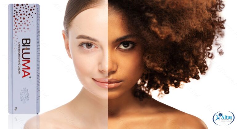 "Biluma Cream: Illuminate Your Skin, Unveil Your Radiance!" Best 1